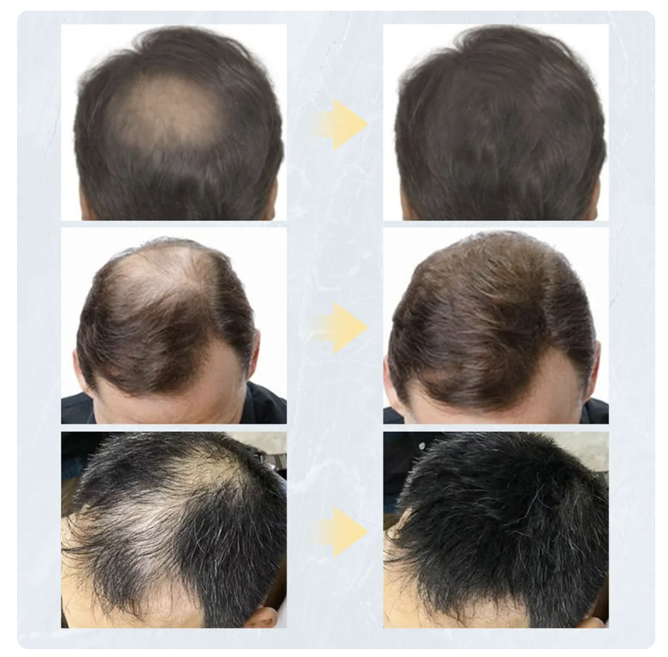 TOPIK Hair Building Fibre Powder Spray – Expirius.sg